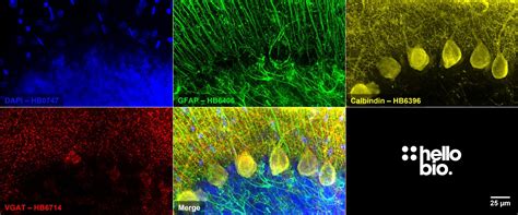 Anti Vesicular Gaba Transporter Vgat Antibody Validab™ Gaba Marker Hb6714