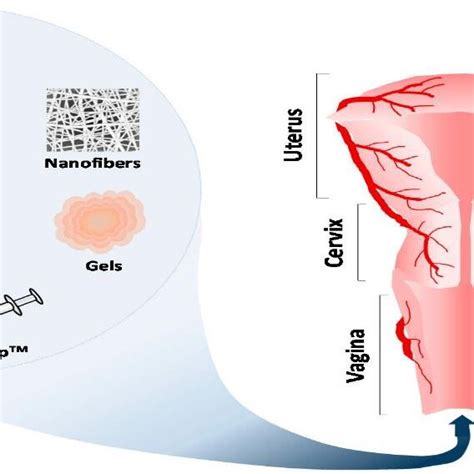 Vaginal Drug Delivery System Download Scientific Diagram