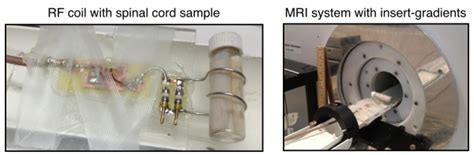 Mapping Tissue Microstructure — Neuropoly Documentation