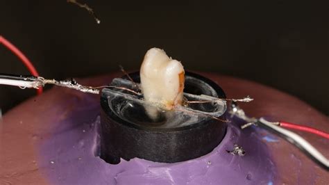 Measuring Polymerization Shrinkage Stress On The Tooth Structure The Essential Blog For