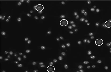 Figure 2 From Hep 2 Specimen Classification Via Deep Cnns And Pattern Histogram Semantic Scholar