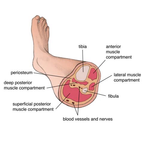 Trigger Point Therapy Tibialis Anterior Anatomy About Trigger