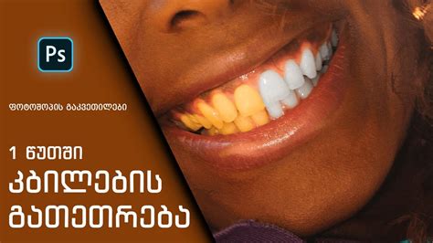როგორ გავათეთროთ კბილები სურათზე Youtube