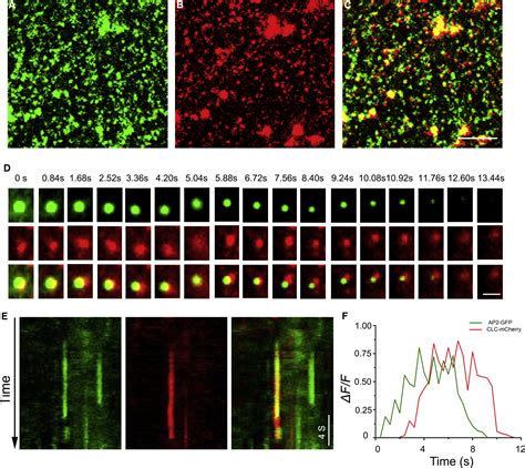 Single Particle Tracking For The Quantification Of Membrane Protein Dynamics In Living Plant