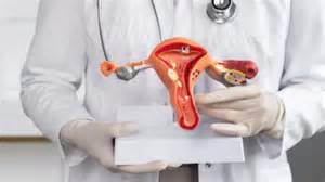 Pcos And Irregular Periods Experts Bust Common Menstrual Myths Health News Zee News