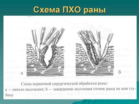 Раны и раневая инфекция. Способы лечения ран - презентация онлайн