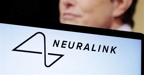 Revelan La Verdad De Los Implantes Cerebrales De Elon Musk Uso De Monos Errores Letales Y Más