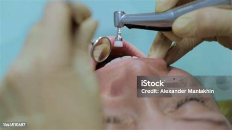 치과에서 치아를 청소하는 여자 치과 의사 양치질 치아 미백 전문 치과 장비로 연마하는 여성 치아의 극단적 인 샷 치과 의사 방문 20 29세에 대한 스톡 사진 및 기타