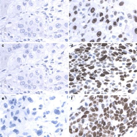 Immunohistochemical Analysis Of Human Mutl Homolog 1 Hmlh1 Human Download Scientific Diagram