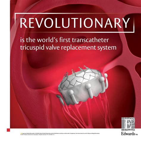 Evoque Tricuspid Valve Replacement Edwards Lifesciences