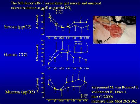 Ppt Classification Of Microcirculatory Abnormalities In Distributive