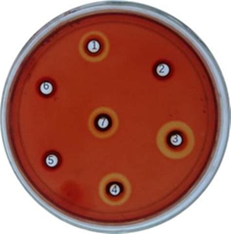 Maps Of The Three Recombinant Plasmid Constructs And Their Download Scientific Diagram