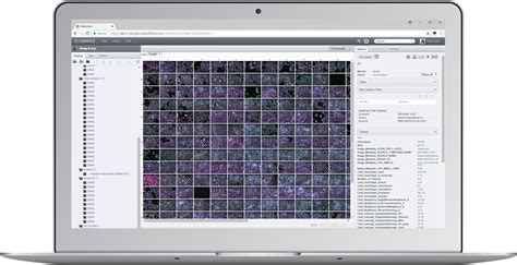 Hcs Image Data Solutions Glencoe Software Inc