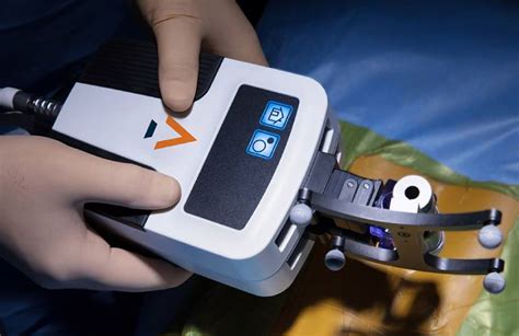 Fda Grants Fluoroscopic Imaging Clearance For Accelus Remi Robot