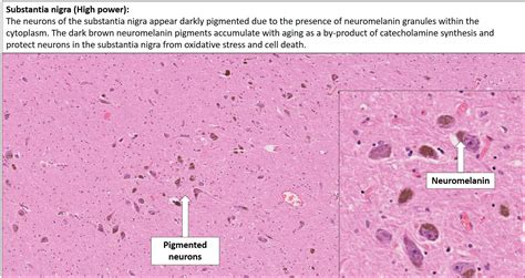 Substantia Nigra Histology Chapter 1 Normal Gross Brain And