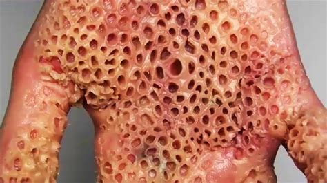 Trypophobia Hand
