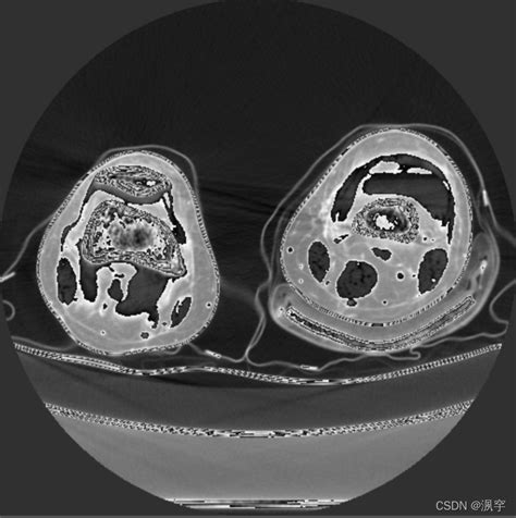 Itk Dicom序列图像读写imageseriesreader Csdn博客