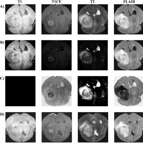 Mri Images A Before Preprocessing And After Being Implemented B Download Scientific Diagram