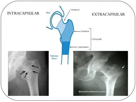 Slide Pfof Slide Pfof