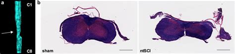 Ntsci Mice Demonstrate Notable Compression Of The Cervical Spinal