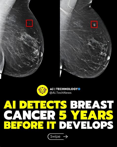 Ai And Chatgpt Tools Technology Aitechnews • Instagram Photos And