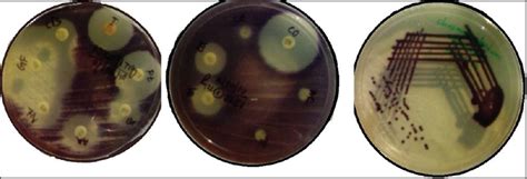 Chromobacterium Violaceum Induced Sepsis And Multiorgan Dysfunction