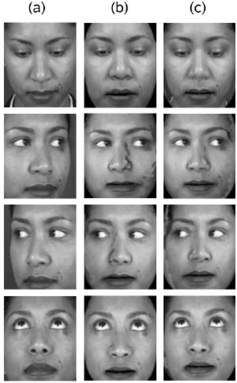 The Effect Of Applying Pose Normalization Algorithms A Original Download Scientific Diagram