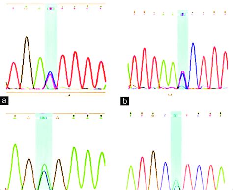 Representatives Of The Four Detected Singlenucleotide Polymorphisms In Download Scientific