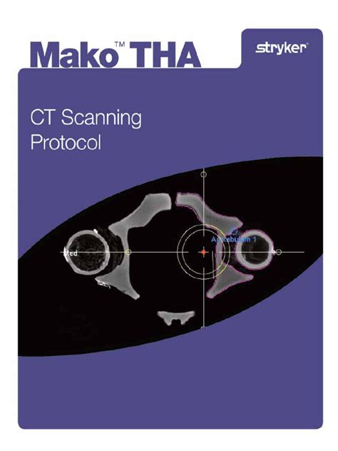 Anexo Ii Mako Tha Ct Scanning Protocol Pdf Pelvis Knee