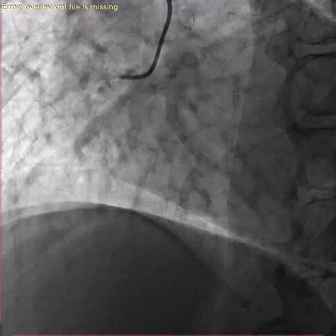 [video] Pavel Somov On Linkedin Cto Rca Cto Epicardial Jcto 12 Comments