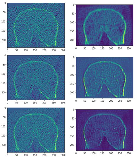 Github Juanigpct Denoising Code Made During The Work Of My Thesis On Ct Denoising For The