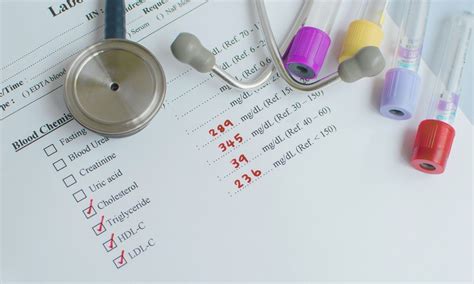 Triglyceride To HDL Cholesterol Ratio Strongly Predicts Diabetes Development Within Years