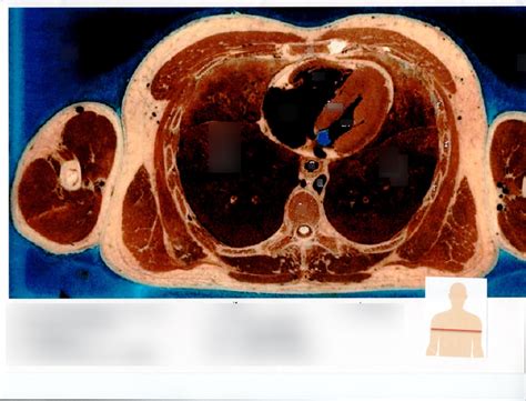 A P Cross Section Diagram Quizlet