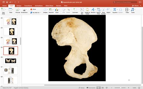 Os Coxae Diagram Quizlet