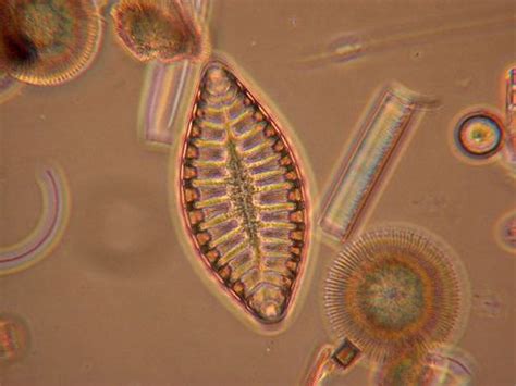 Diatoms Under Microscope 400x