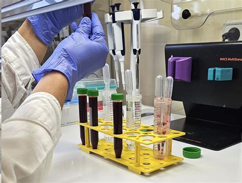 The Mysterious Eosinophils And Eusinophil Control In Asthma Lsmu