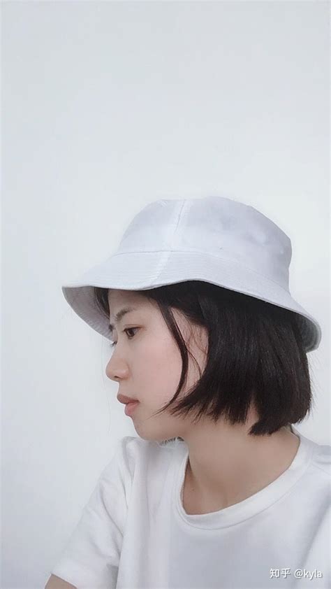 请问我这是骨性还是牙性龅牙 知乎