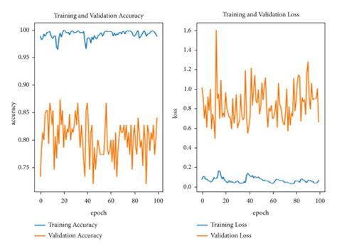 Accuracy And Loss With Ensemble Transfer Learning Model Download