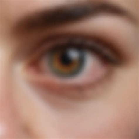 Understanding Chlamydia In The Eye Symptoms And Implications