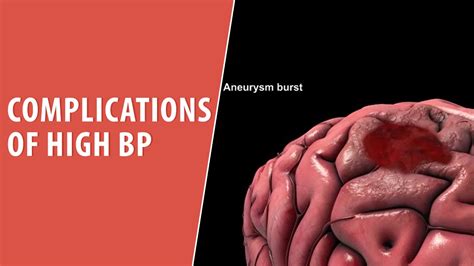 Repatha SureClick Autoinjector