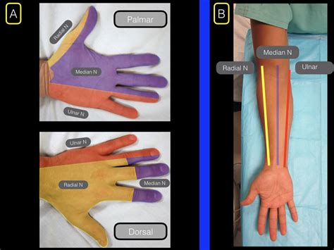Forearm Blocks Highland EM Ultrasound Fueled Pain Management