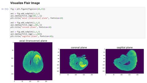 GitHub Ierolsen Brain Tumor Segmentation BraTS This Repo Contains Brain Tumor