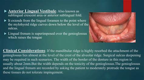 Maxillary And Mandbular Anatomical Landmarks Pptx Dental Health