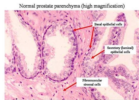 Prostate Histology Labeled Basic Anatomy And Histology Of The Prostate