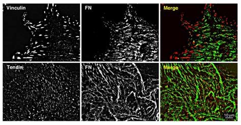 Different Spatial Relationships Between Fibronectin Fibrils And The Download Scientific Diagram