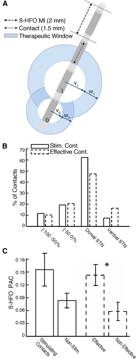 Clinical Correlations Of Pac A Schematic Of Dbs Lead With Four