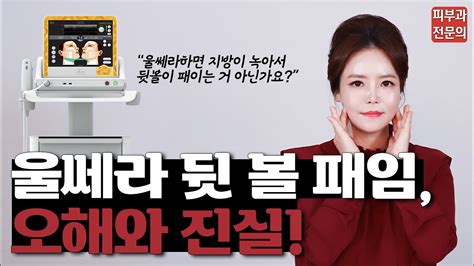 울쎄라 뒷볼패임 오해와 진실 울쎄라부작용 울쎄라볼패임 Youtube
