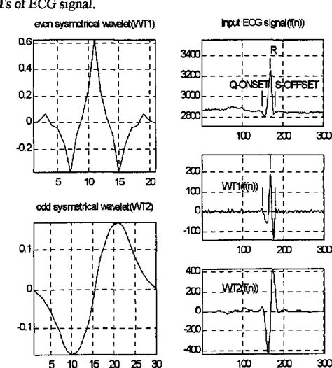 Figure 1 From Qrs Complex Detection By The Combination Of Maxima And