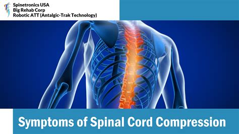 Spinal Cord Compression Symptoms Causes And Relief By Big Rehab Corp
