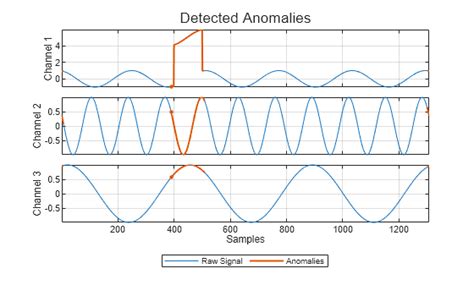 Deepsignalanomalydetector Create Signal Anomaly Detector Matlab